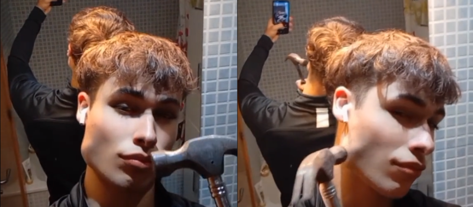 'Bone smashing', la peligrosa tendencia en TikTok que destruye huesos y ...